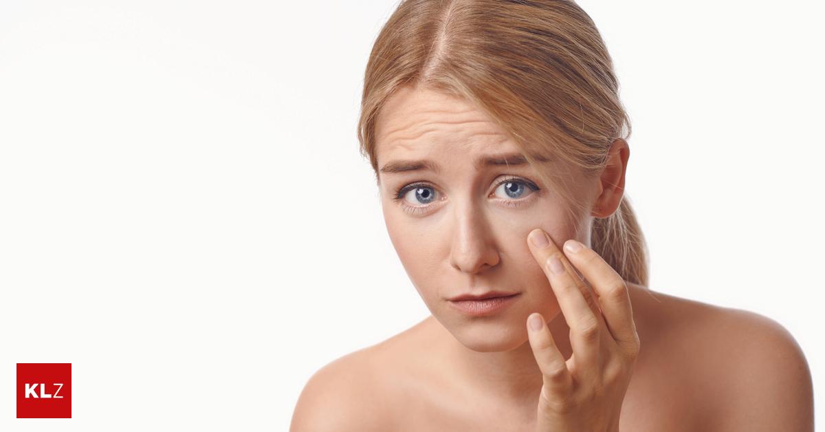 Selbst ausgedrückt: Pickel bringt Frau in Notaufnahme